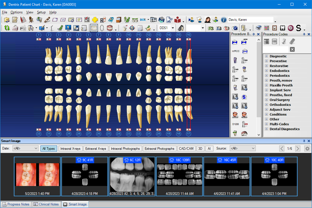 Dentrix Help
