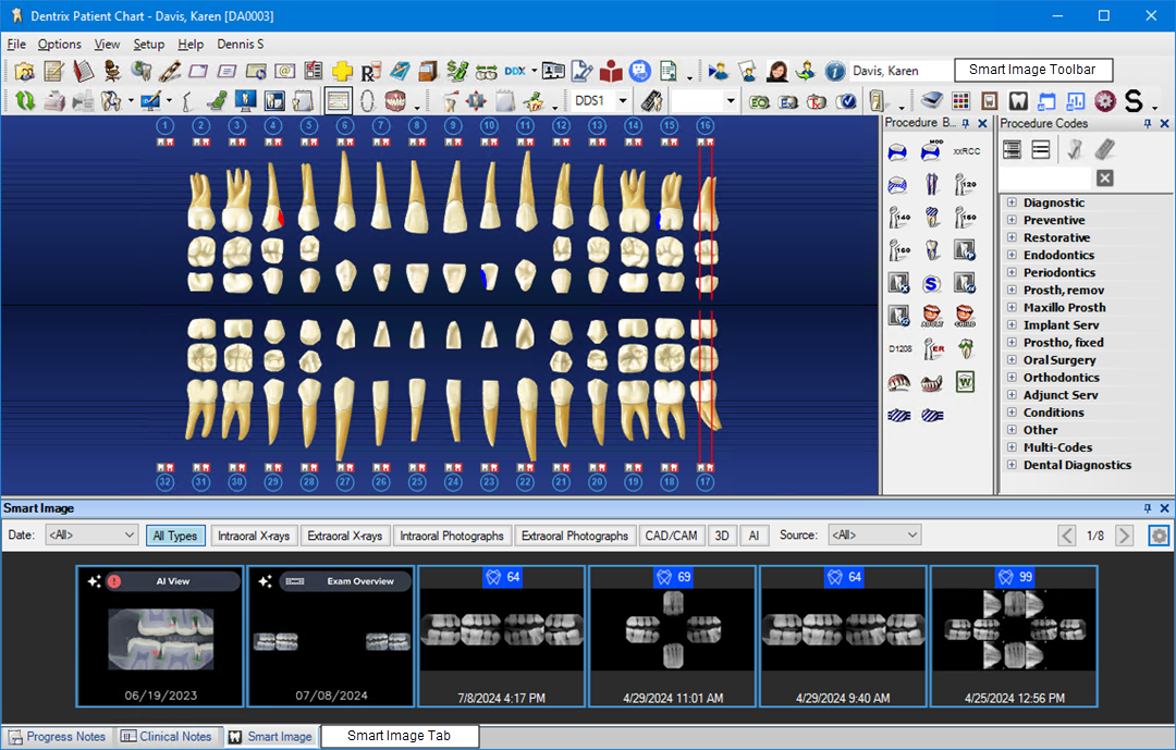 The Patient Chart and Smart Image