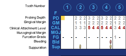 The Data Chart overview