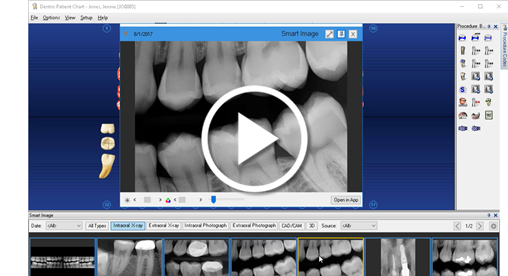 Dentrix Smart Image Videos