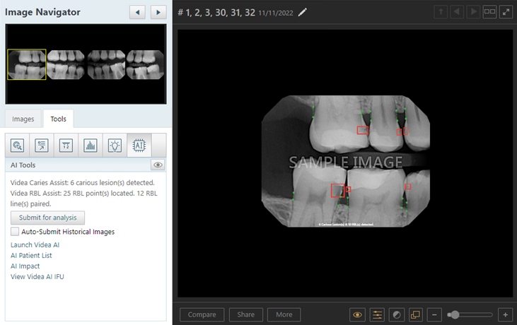Dentrix Ascend Imaging User's Guide
