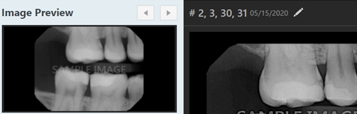 Assigning tooth numbers to images