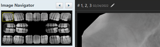 Assigning tooth numbers to images