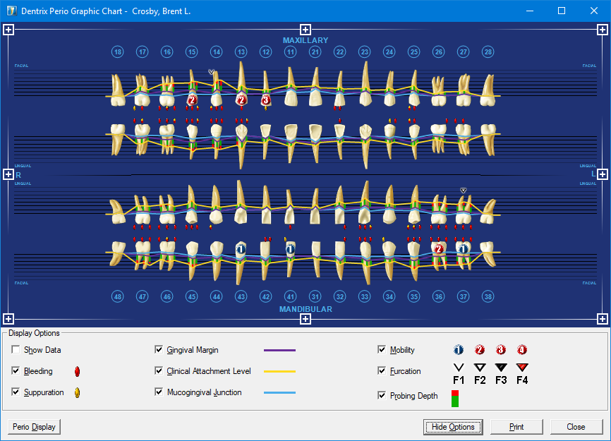 Perio Chart - Viewing the Graphic Chart