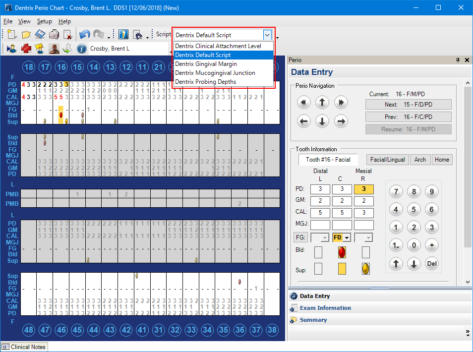 Perio Chart - Entering perio measurements
