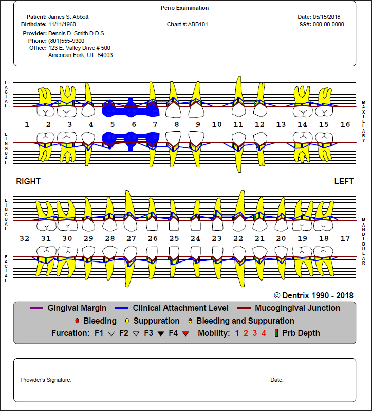 Perio - Graphic Chart Report